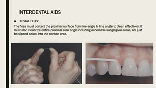mechanical plaque control, periodontics | PPTX