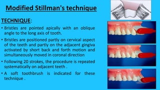 Mechanical plaque control new | PPTX