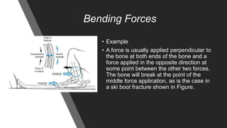 Mechanical Properties Of Bone | PPTX
