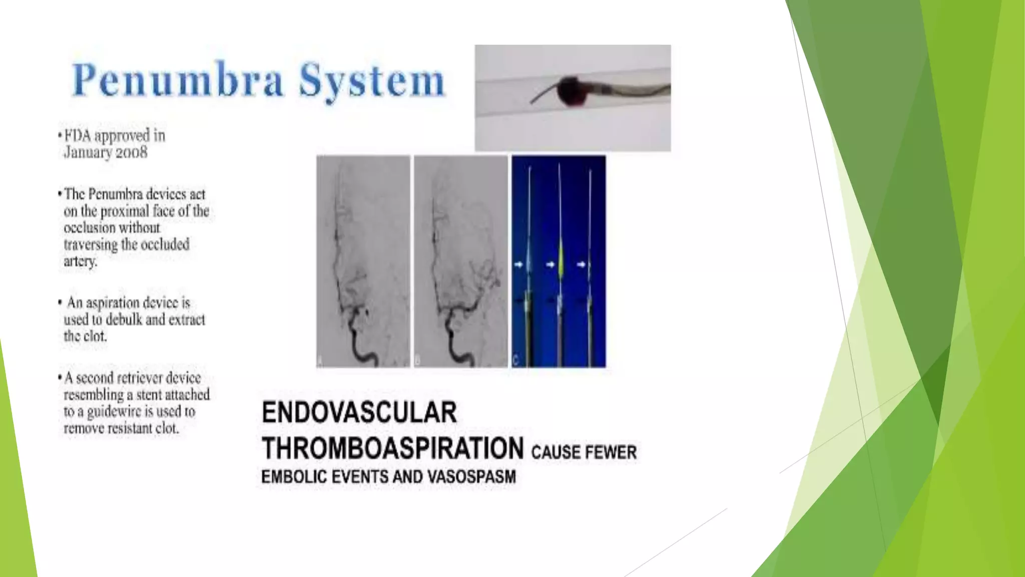 Mechanical thrombectomy in acute stroke [Autosaved].pptx