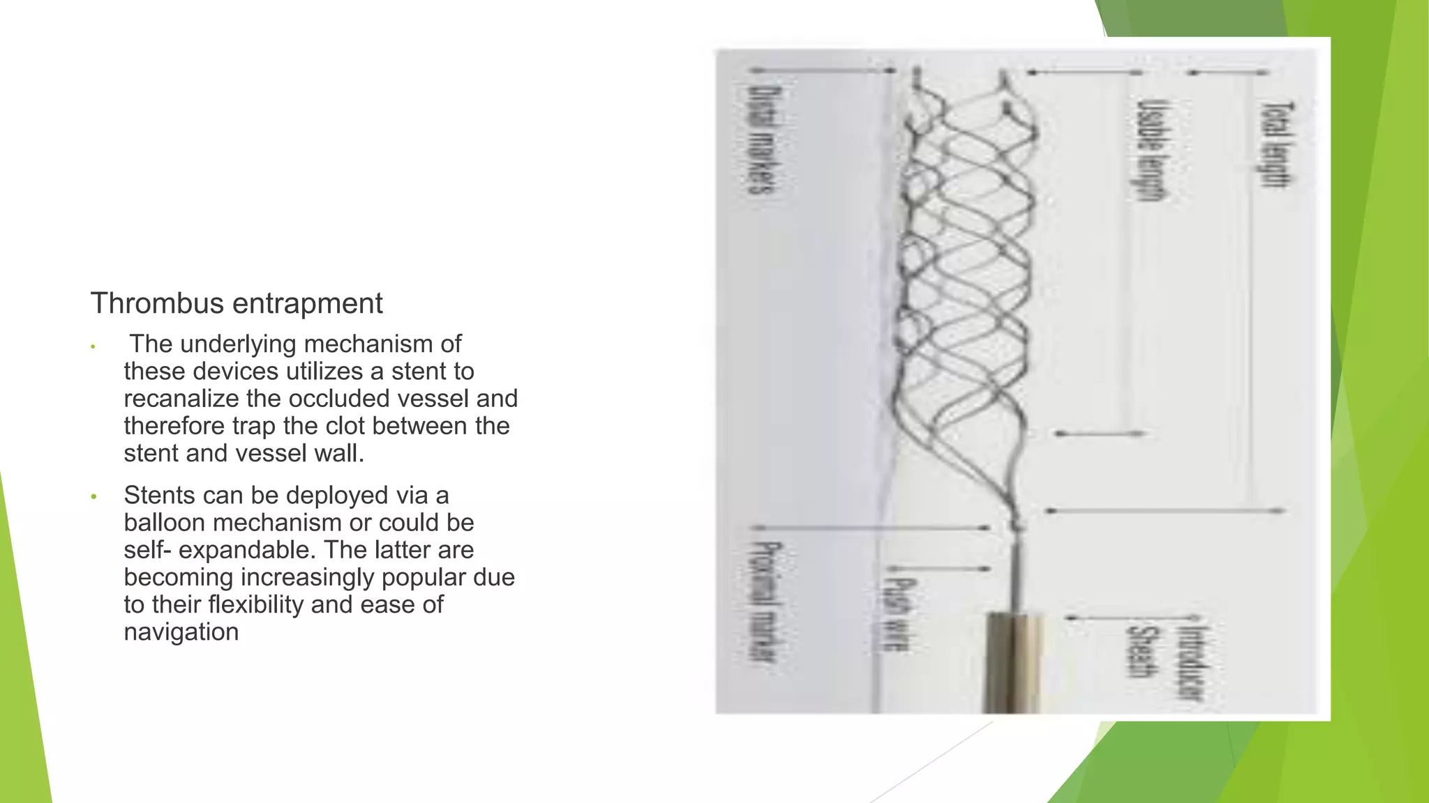 Mechanical thrombectomy in acute stroke [Autosaved].pptx