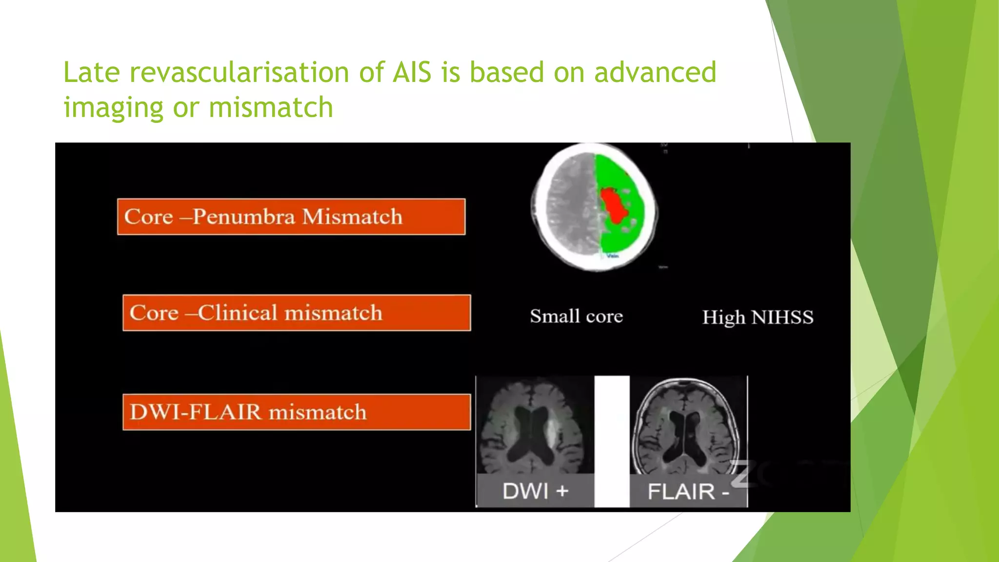 Mechanical thrombectomy in acute stroke [Autosaved].pptx