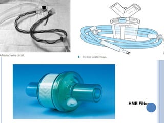 Mechanical ventilation | PPTX