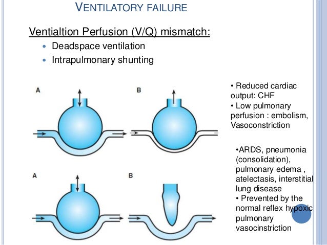 Mechanical ventilation