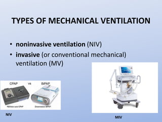 Mechanical ventilation | PPTX