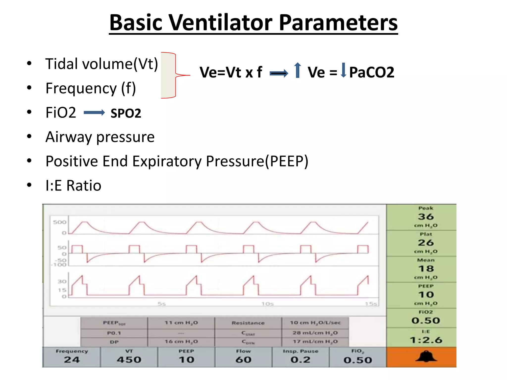 Mechanical ventilation | PPTX