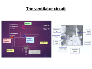 Mechanical ventilation | PPTX