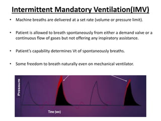 Mechanical ventilation | PPTX