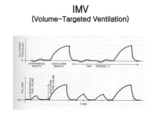Mechanical ventilation | PPT
