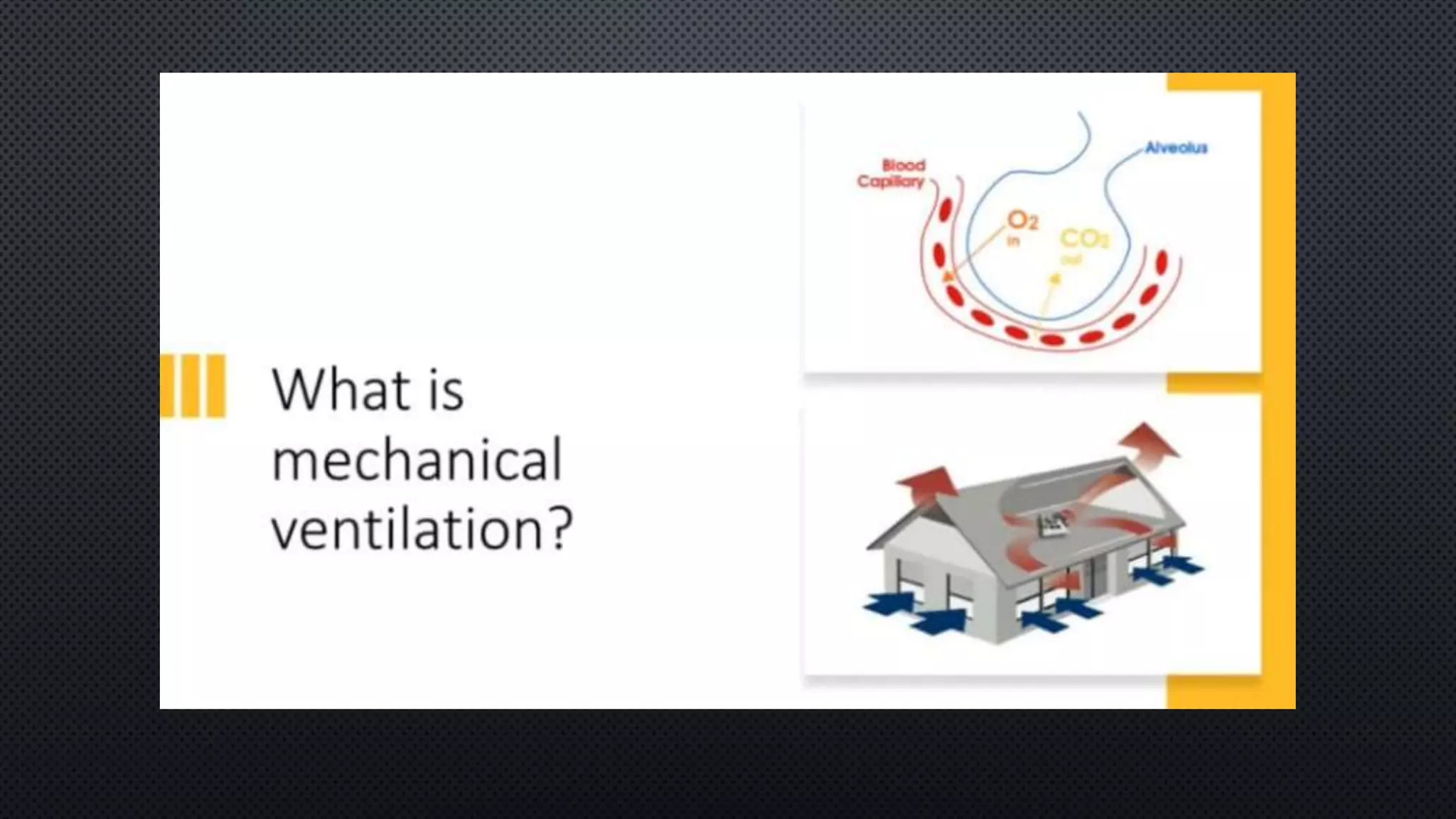 Essentials of Mechanical ventilation | PPT
