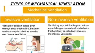 Mechanical ventilation and physiotherapy management | PPT