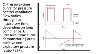 Mechanical Ventilation.pdf
