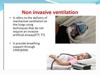 Ppt Advanced Modes Of Mechanical Ventilation Powerpoint