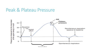 mechanical ventilation.pdf