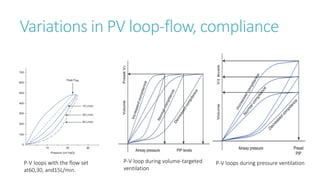 mechanical ventilation.pdf
