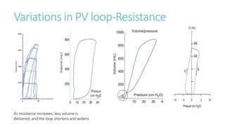 mechanical ventilation.pdf