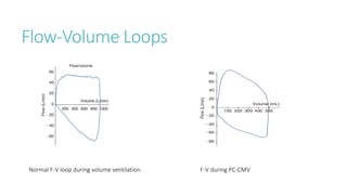 mechanical ventilation.pdf