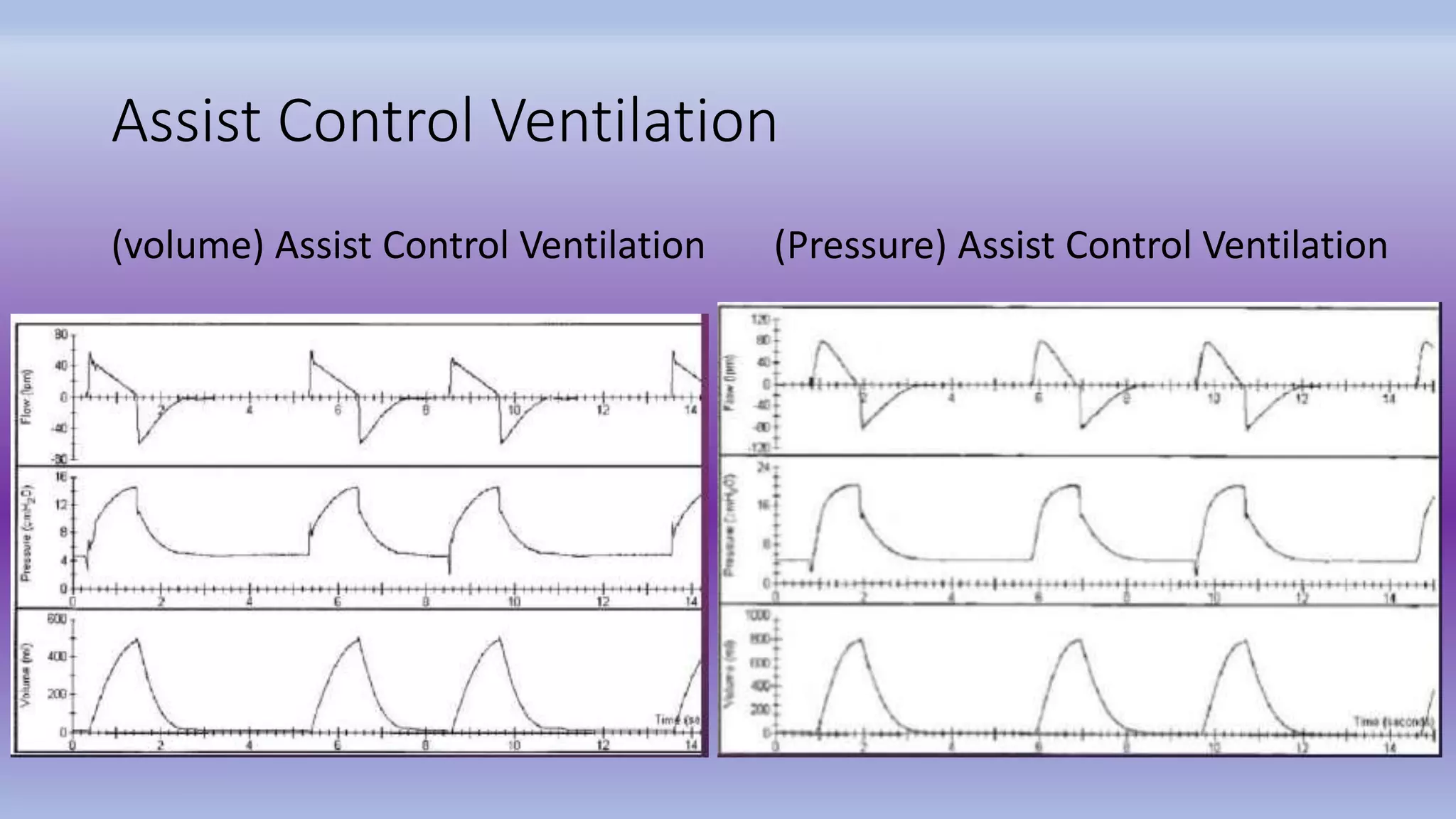Mechanical Ventilation.pptx