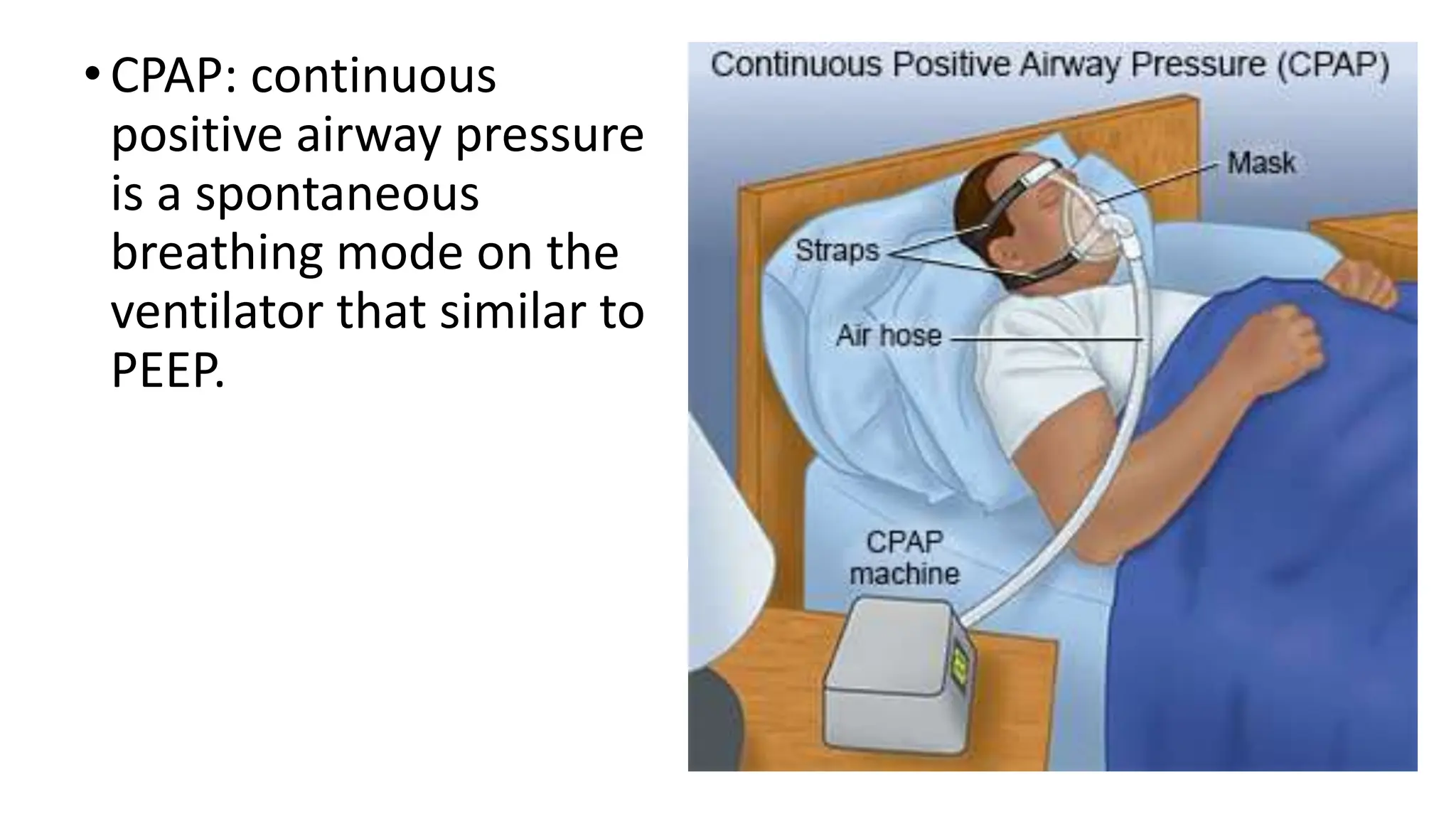 Mechanical Ventilation.pptx