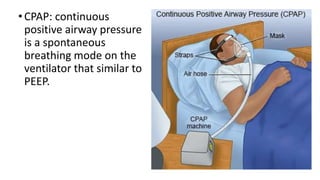 Mechanical Ventilation.pptx