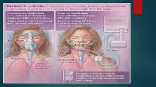 MECHANICAL VENTILATION.pptx,description inside | PPTX