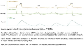 Slideshow on Mechanical Ventilation .pdf