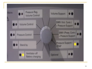 Mechanical Ventilation required in ICU setting | PPT
