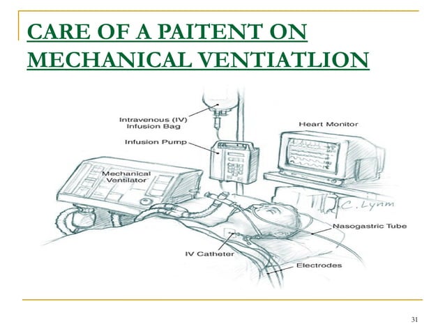 Mechanical Ventilation required in ICU setting | PPT