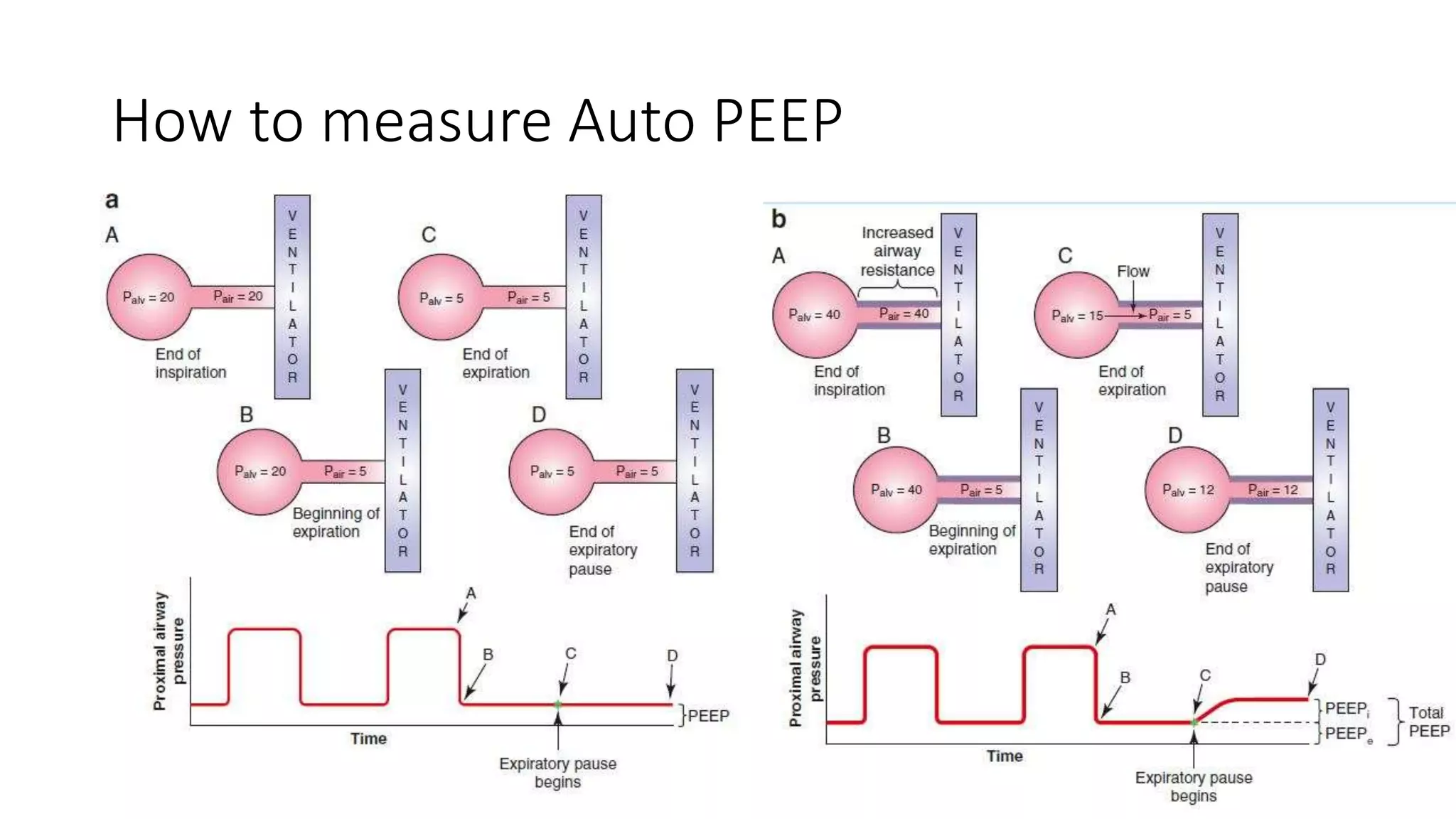 Mechanical ventilation 6- in obstructive airway disease | PPTX