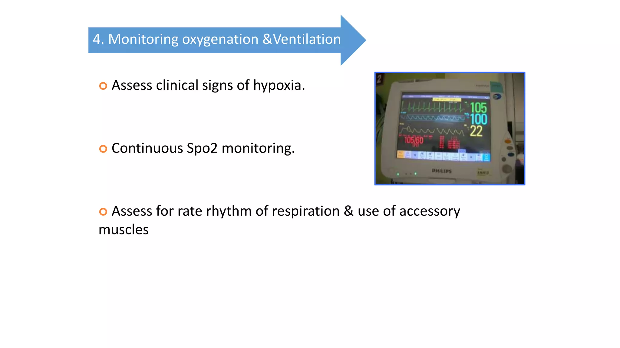 Mechanical ventilation intro | PPTX