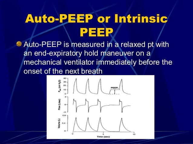 Mechanical ventilation[1]