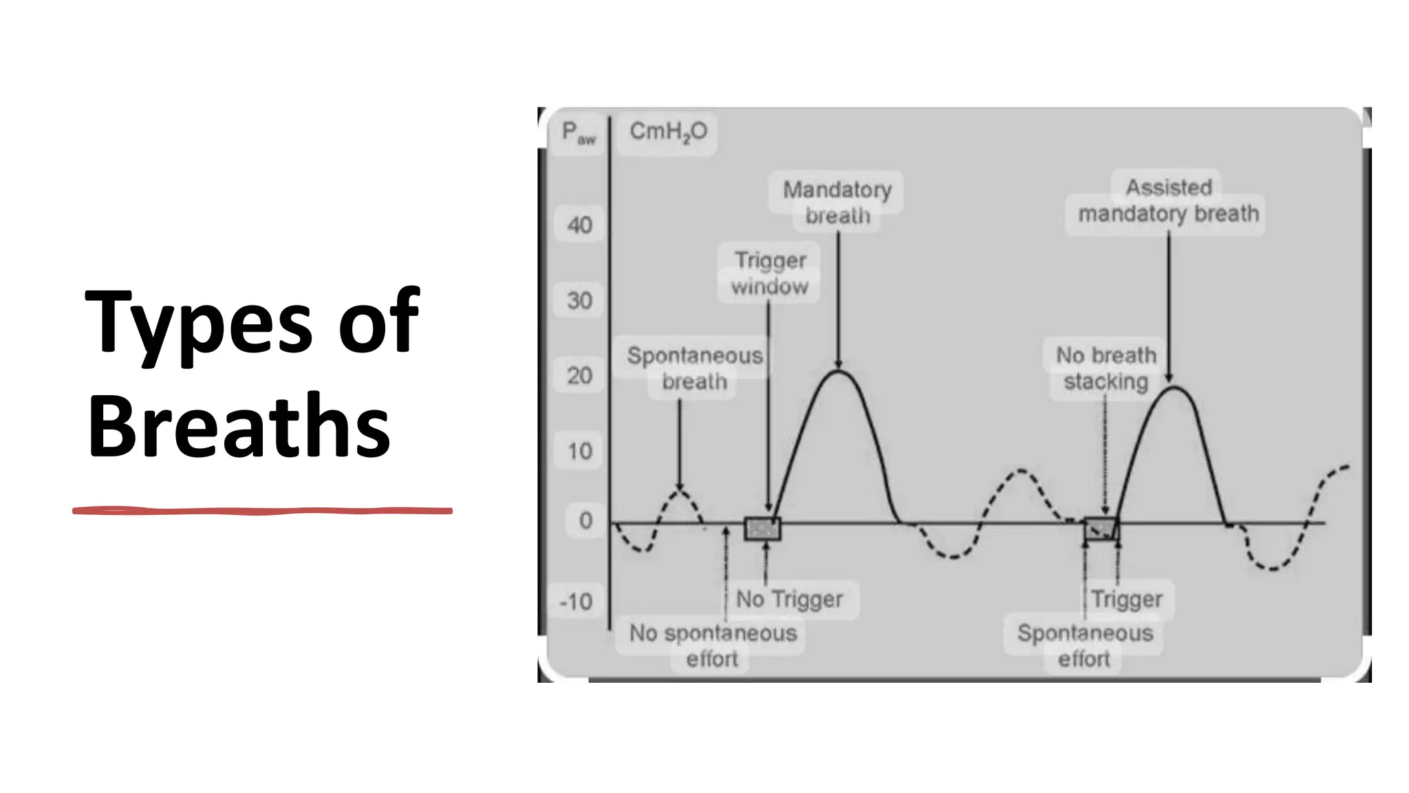 Mechanical Ventilation basics and modes(7).pptx