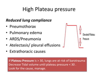 Mechanical ventilation basics | PPTX