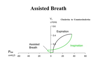 MECHANICAL VENTILATION BASICS OF OPERATION .ppt