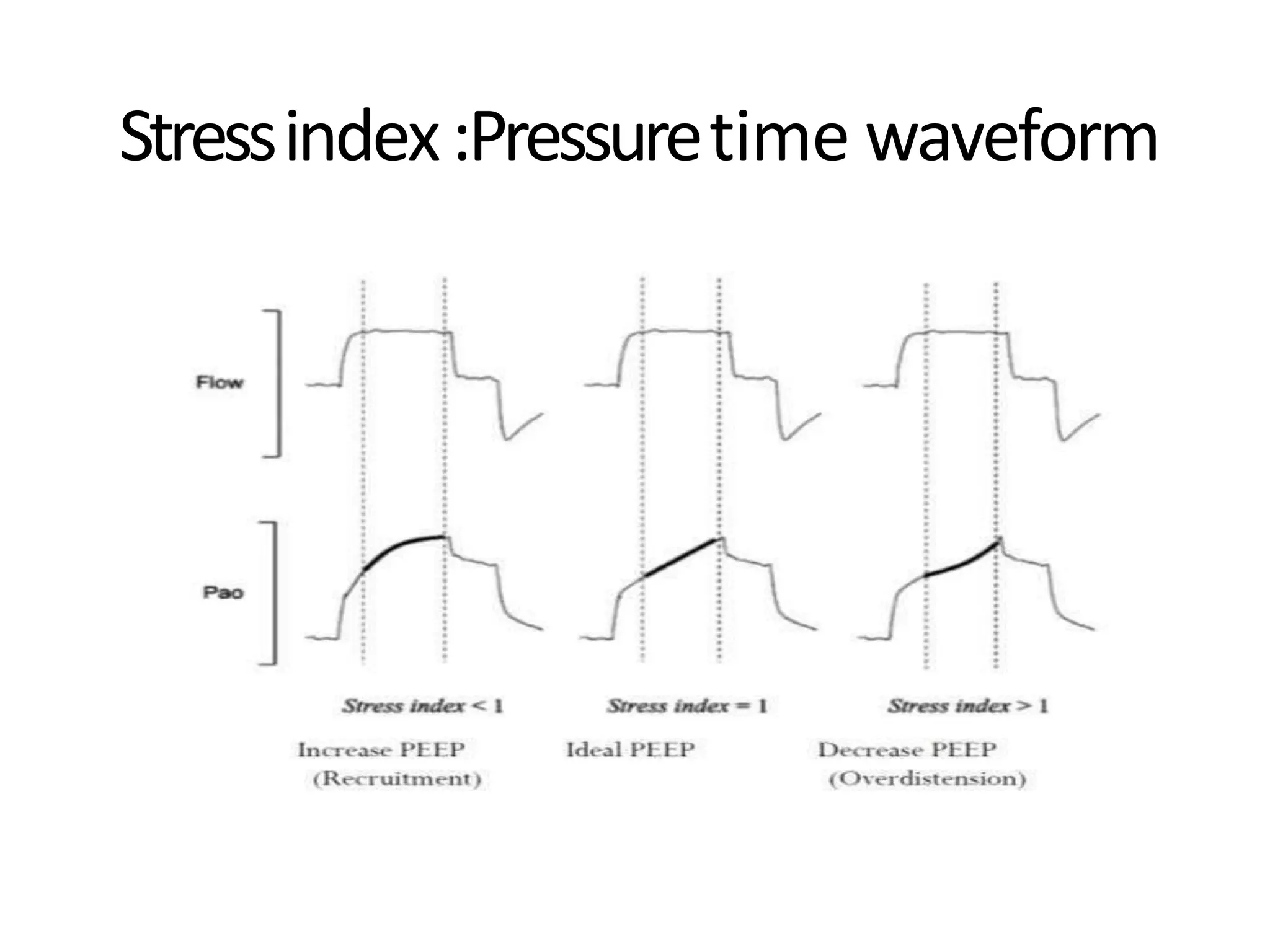 Mechanical ventilation Basics and waveforms | PPTX