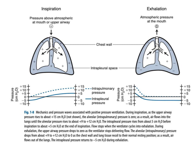 Mechanical ventilation Basics and waveforms | PPTX | Lung and ...