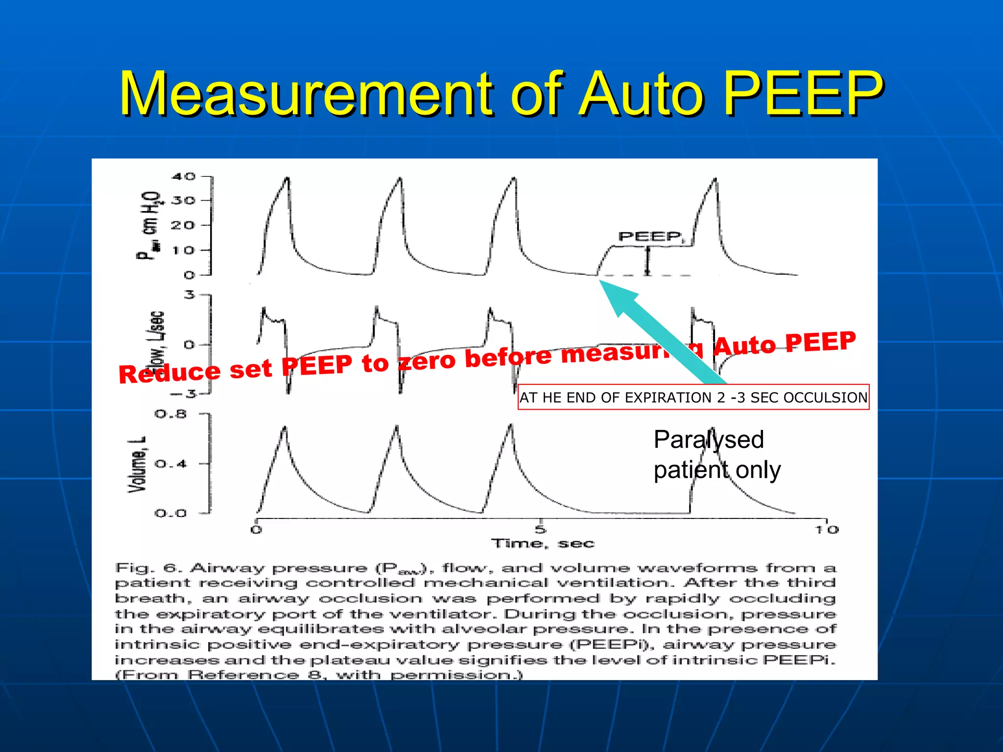 Mechanical ventilation in COPD Asthma drtrc | PPT