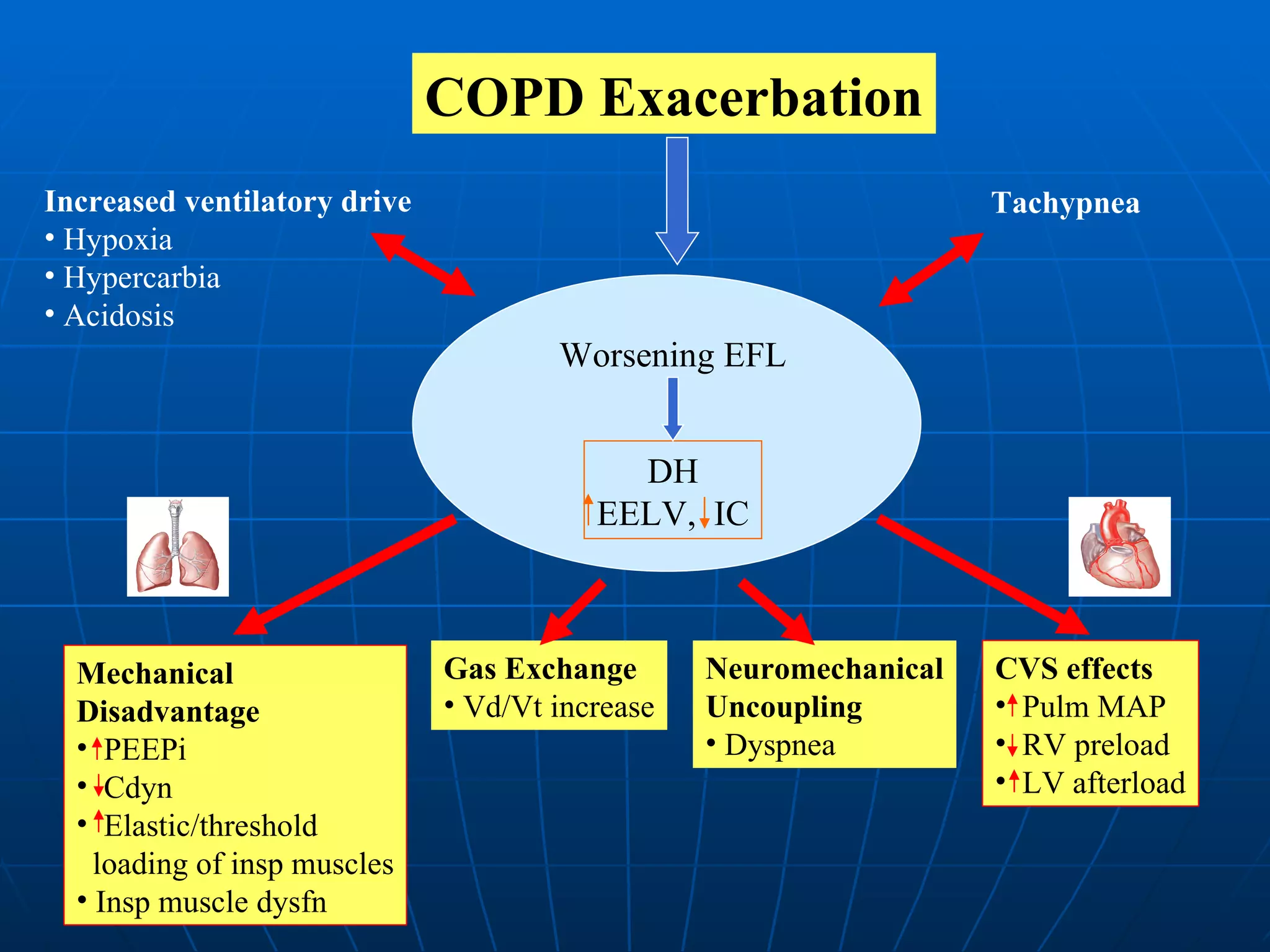 Mechanical ventilation in COPD Asthma drtrc | PPT