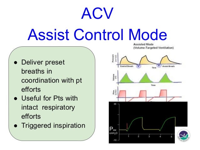 How to initiate mechanical ventilation in Emergency room?
