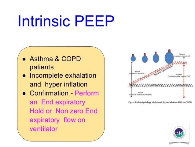 How to initiate mechanical ventilation in Emergency room?