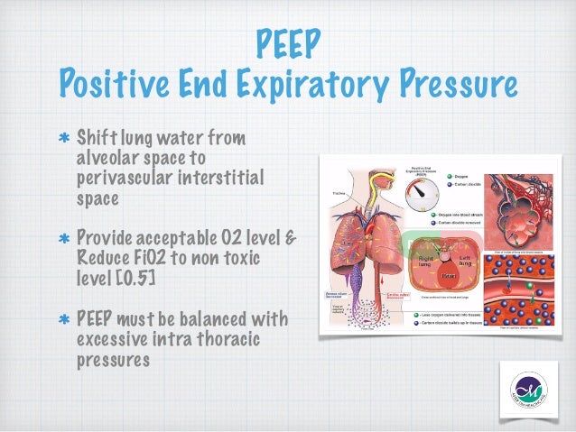 Mechanical ventilation in emergency department