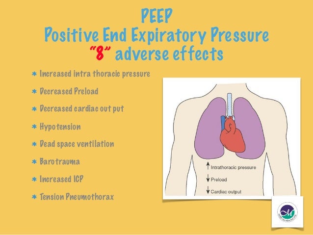 Mechanical ventilation in emergency department