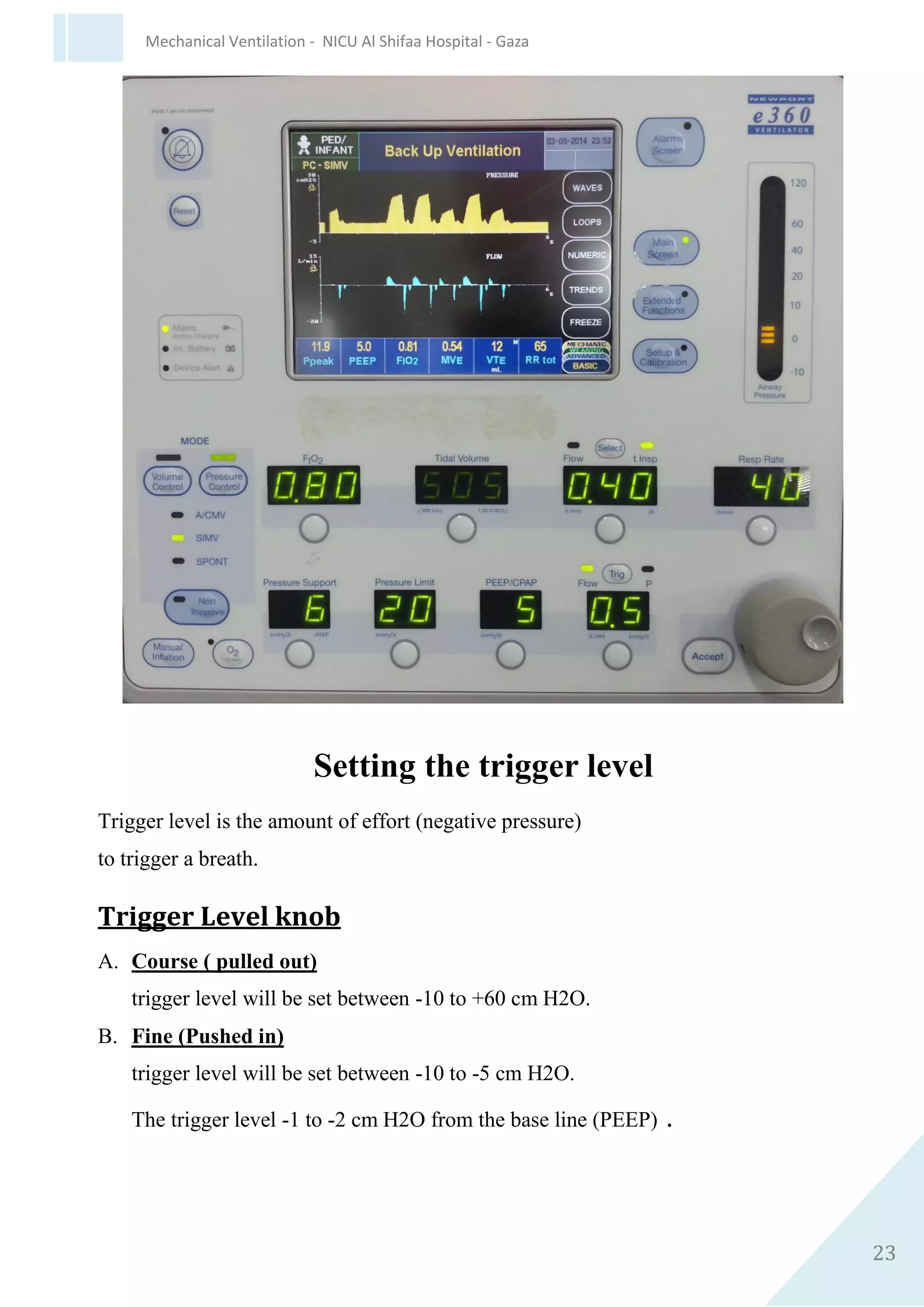 Mechanical ventilation in neonates | PDF