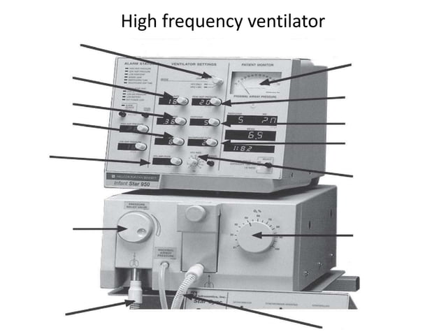 Mechanical ventilation in neonates by dr naved akhter | PPT