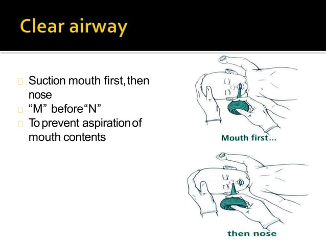 Mechanical ventilation & intubation for neonates | PPTX | Lung and ...