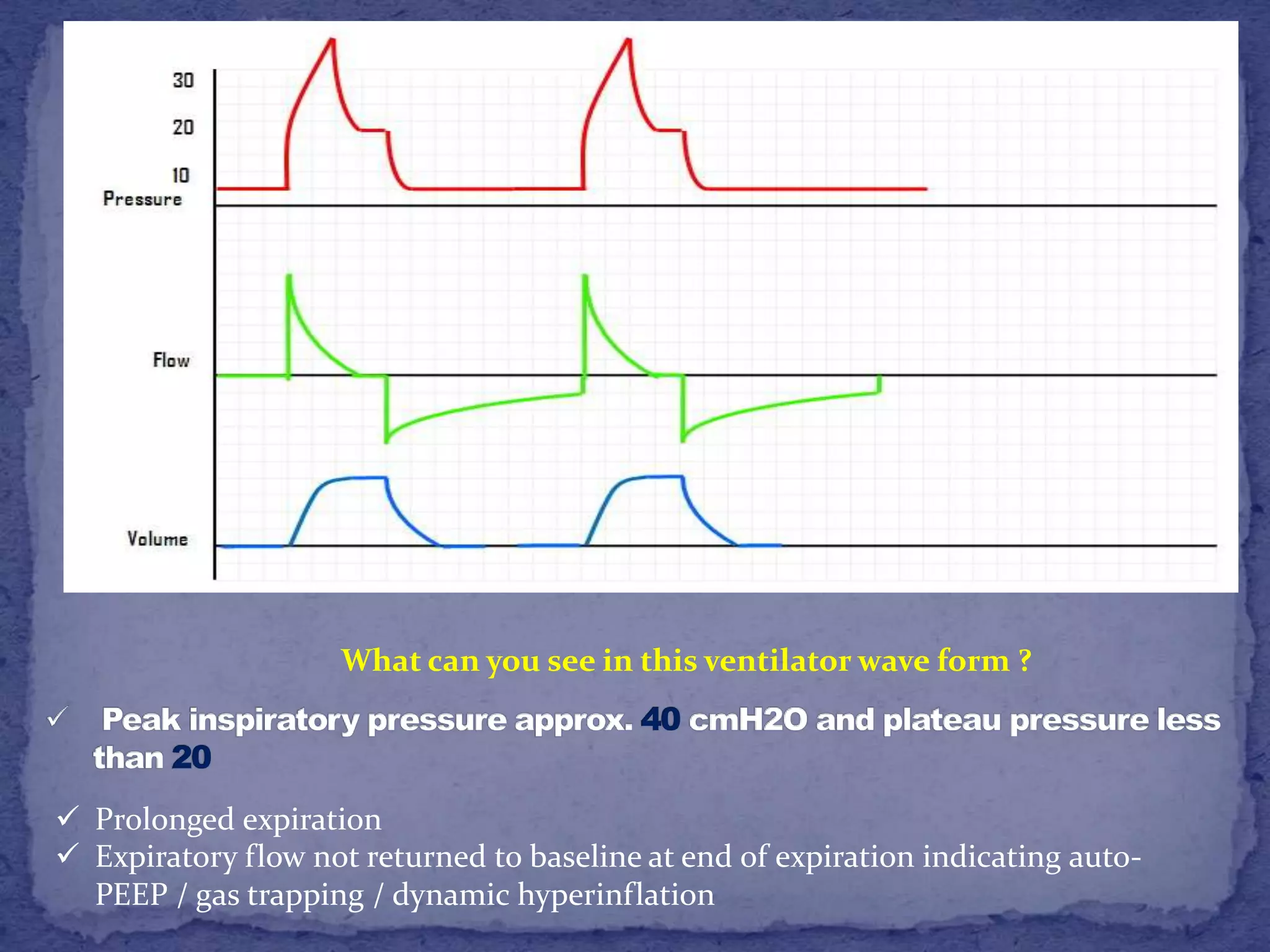 Mechanical ventilation of bronchial asthma, is it a real dilemma | PPTX