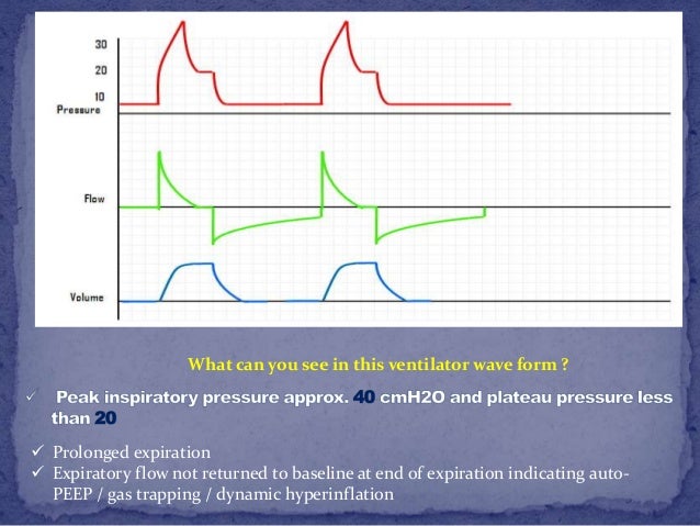 Mechanical ventilation of bronchial asthma, is it a real dilemma