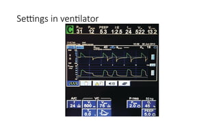 Mechanical Ventilation ppt.pptx including indications, types | PPTX