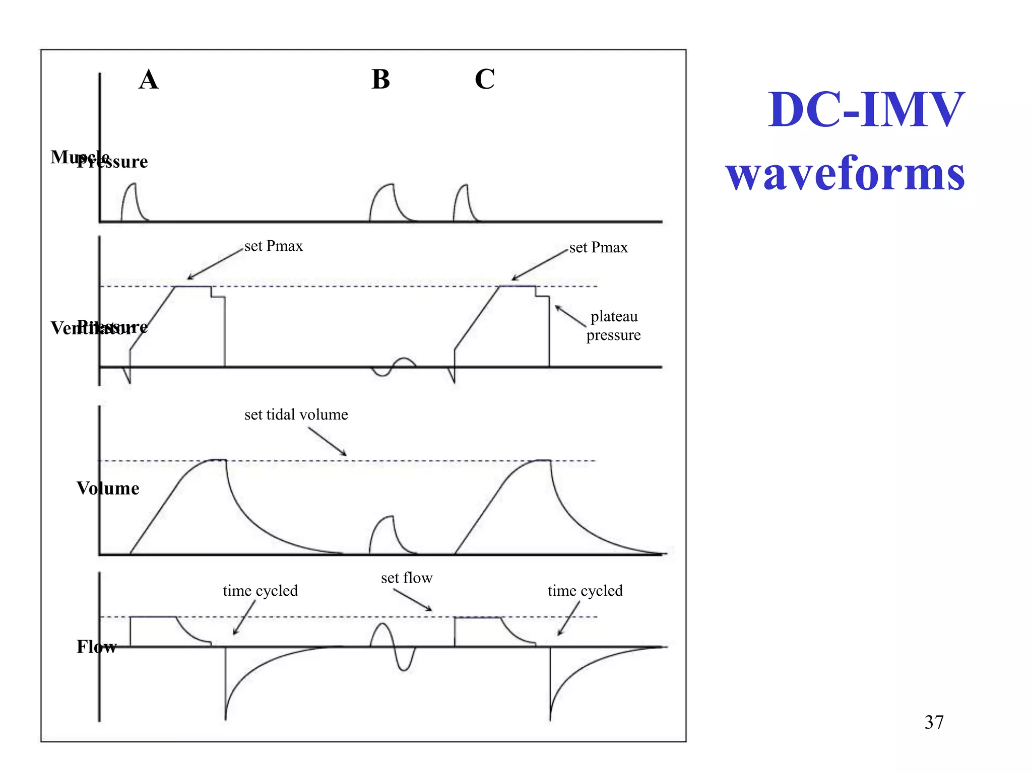 Mechanical ventilation, understanding modes. | PPTX