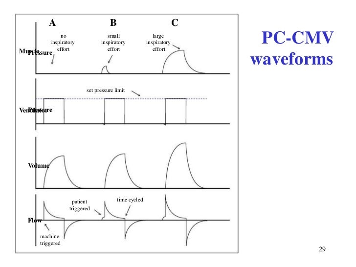 Mechanical ventilation, understanding modes.